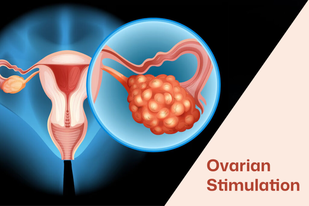 Is IVF Painful? Discomfort and Mild Pain | Corion Fertility Clinic